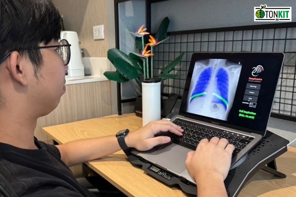 'Deep Inspire' ลดถ่ายซ้ำ X-ray ปอด สู่ทางรอดผู้ป่วยด้วยเทคโนโลยี AI ...
